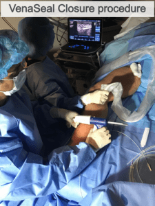 VenaSeal Closure System by Medtronic - Success Story | Advanced Heart ...
