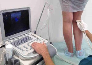 Am I a Candidate for a Leg Arterial Ultrasound?